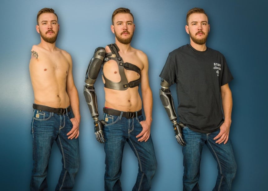 Featured Patients | Arm Dynamics Featured Patients | Arm Dynamics